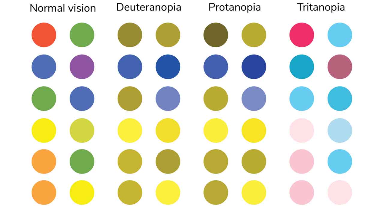 Foresight Clunky Deficit Different Types Color Blindness Here Replace 
