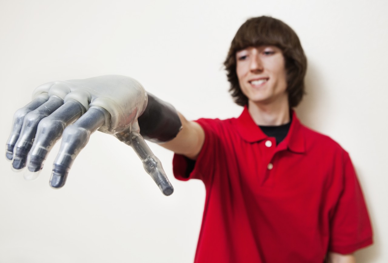Modern Prosthetic Hands Are More Advanced | YourCareEverywhere