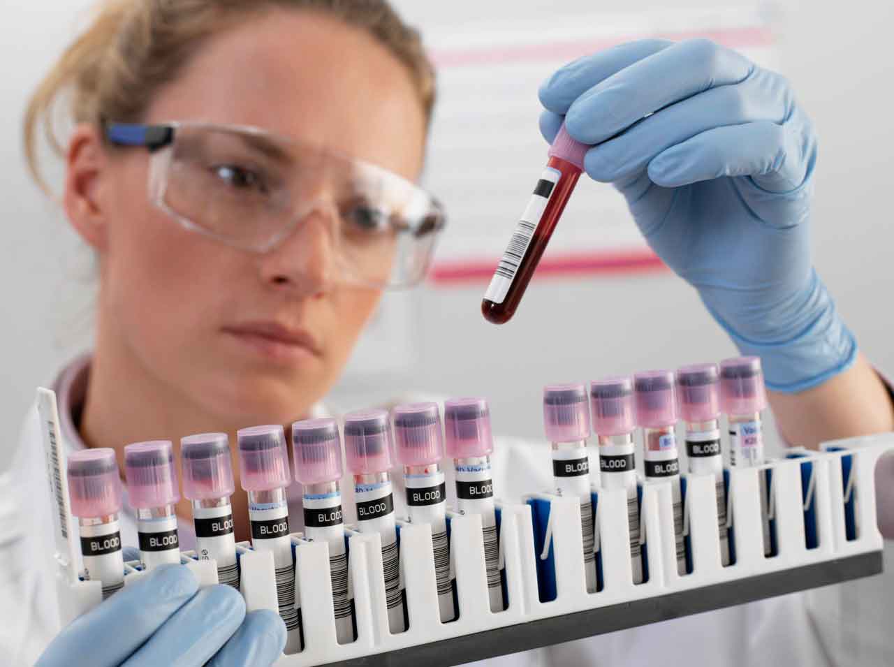 Can Lab Tests Steer You Wrong? | YourCareEverywhere